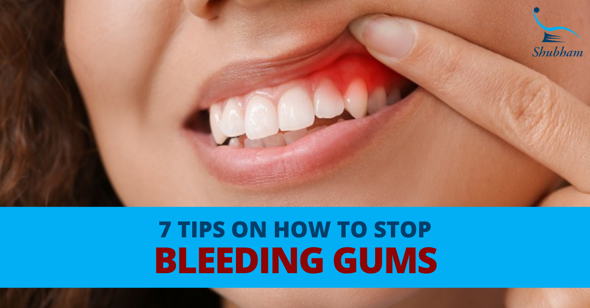 7 TIPS TO HOW TO STOP BLEEDING GUMS - Shubham Dental Clinic