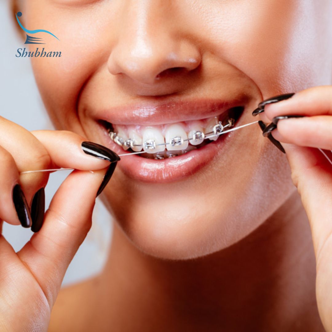 11 Best Tips to Care For Your Dental Braces - Shubham Dental Clinic